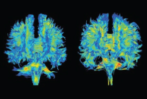 Research Areas - Department of Physical Therapy